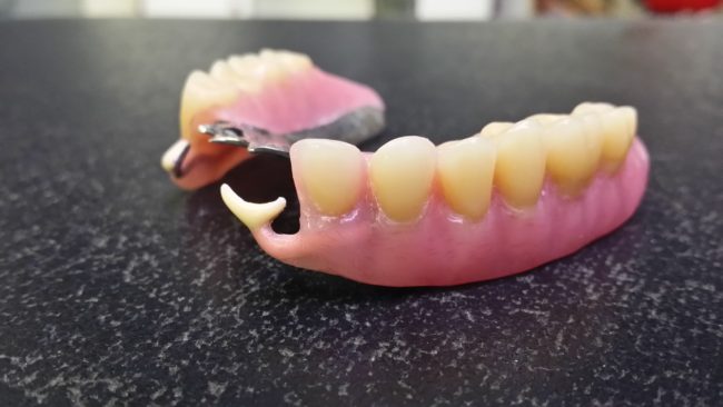 Μερικές Οδοντοστοιχίες – DentalLabOrama.gr