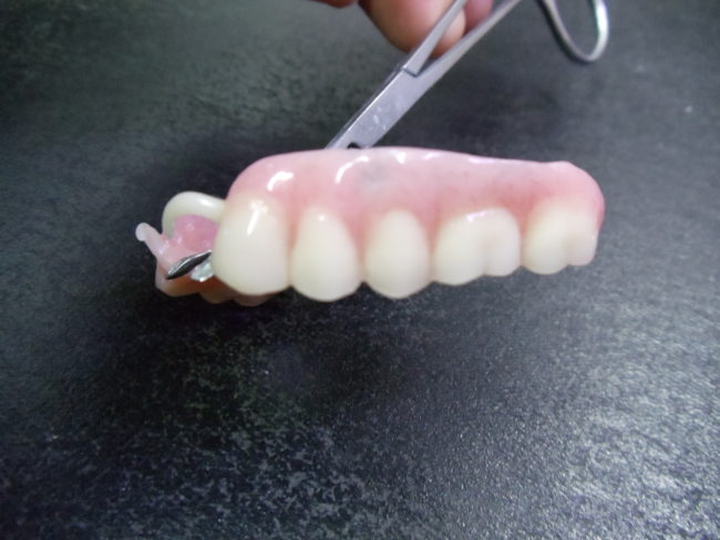 Μερικές Οδοντοστοιχίες – DentalLabOrama.gr