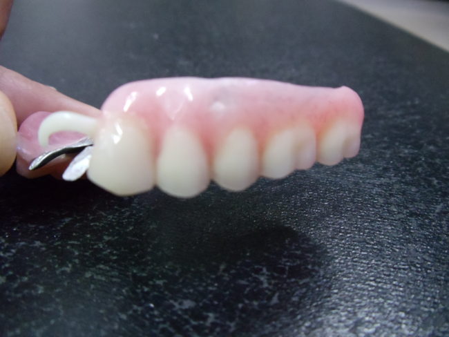 Μερικές Οδοντοστοιχίες – DentalLabOrama.gr