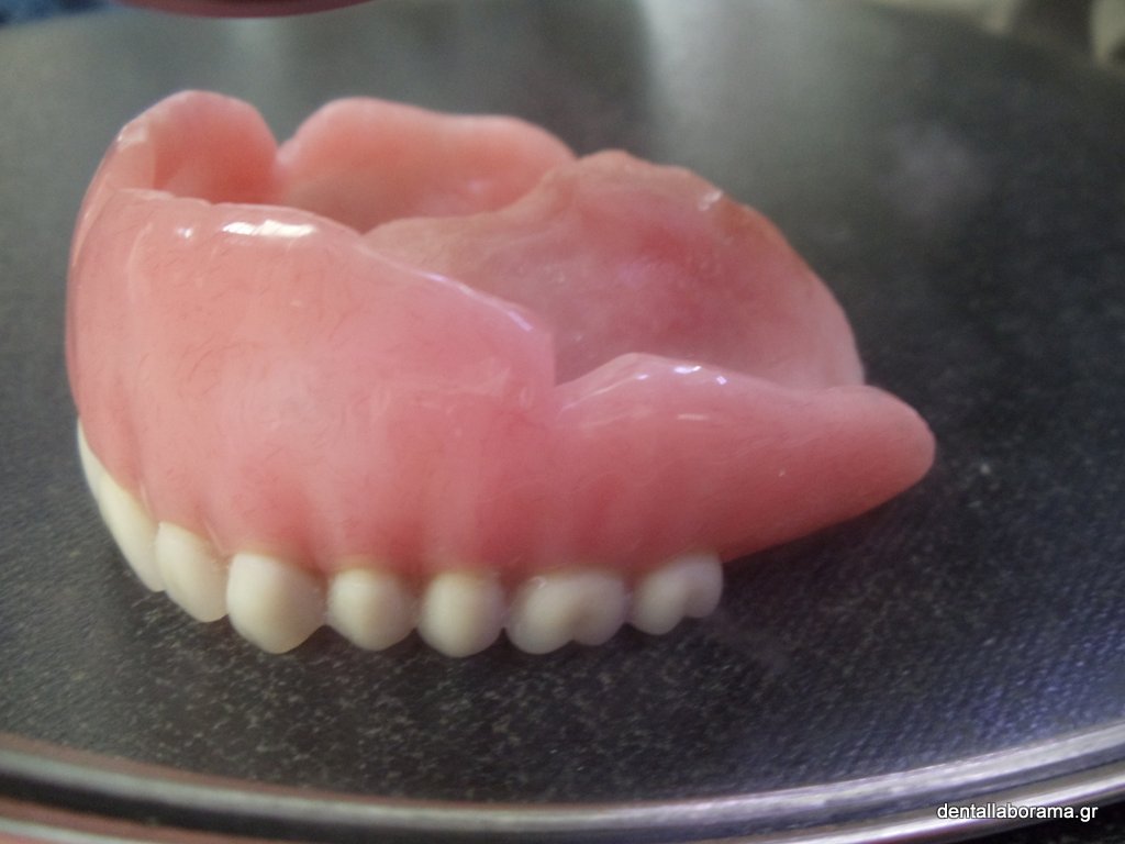 Γναθοστοματική Προσθετική Αποκατάσταση – DentalLabOrama.gr